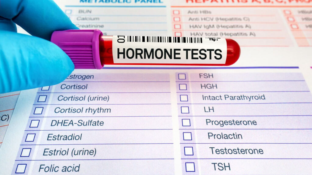 Hormone Testing - Clinical Diagnostic Laboratory