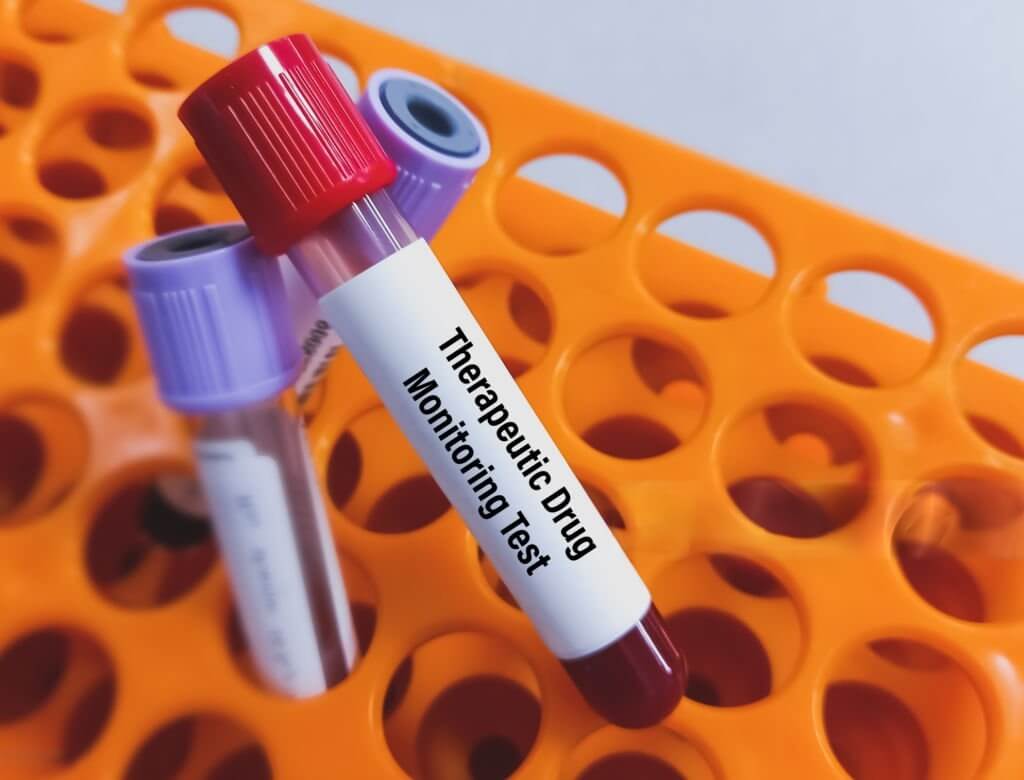 Therapeutic Drug Testing (TDM) - Clinical Diagnostic Laboratory