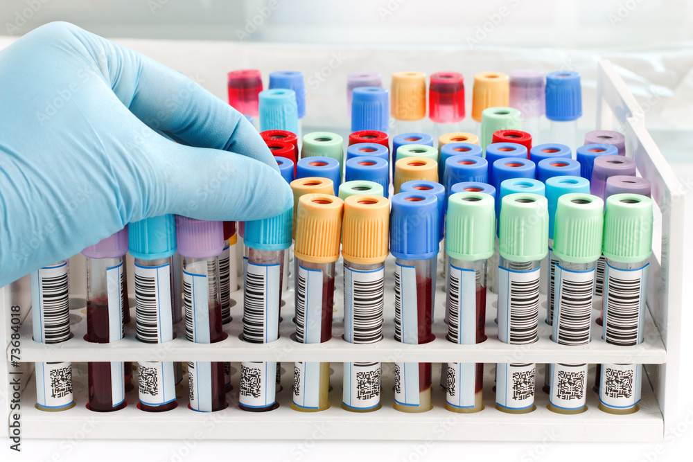 Routine Chemistries - Clinical Diagnostic Laboratory